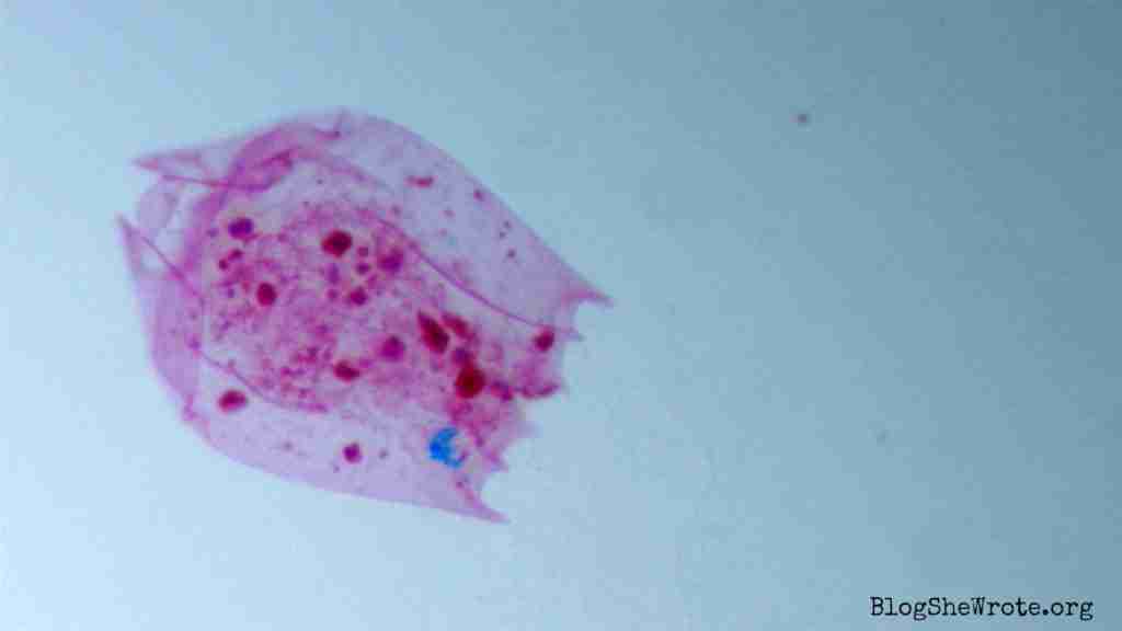 The Beginner's Guide to Microscopic Life in a Pond - Blog, She Wrote