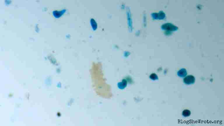 The Beginner's Guide to Microscopic Life in a Pond - Blog, She Wrote